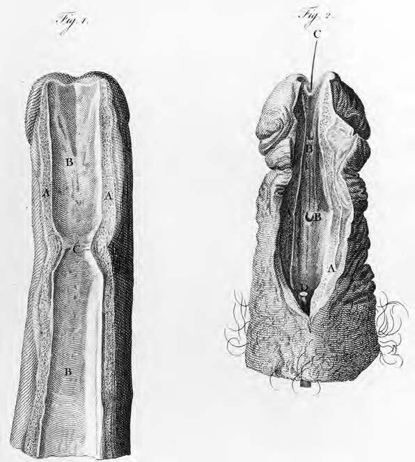 극혐주의 호주 원주민 남성들의 충격적인 성인식jpg